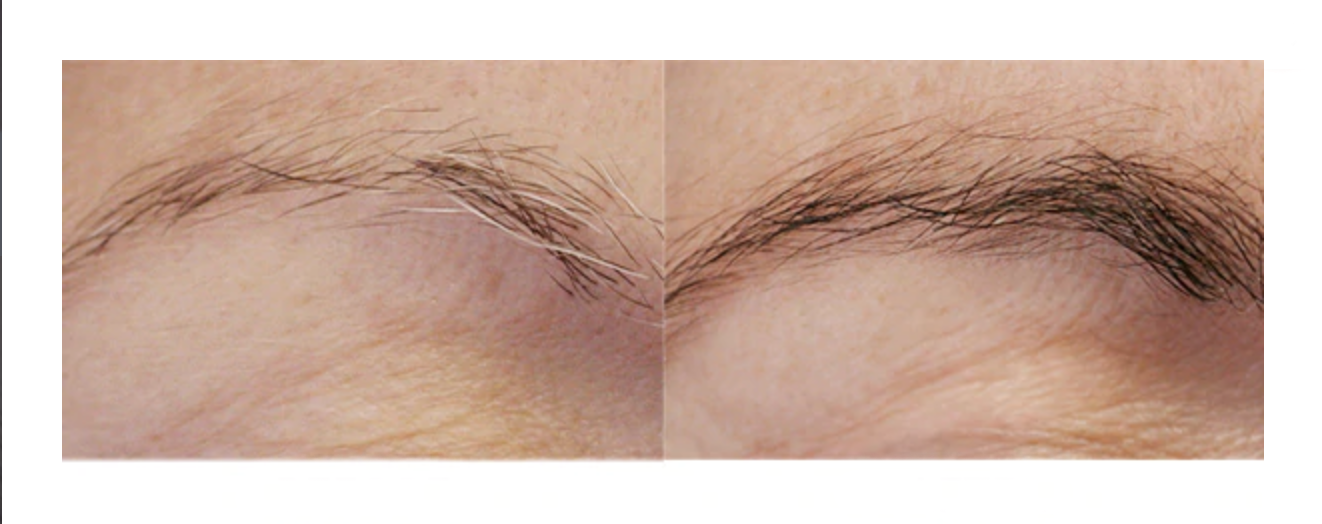 RapidBrow Eyebrow Enhancing Serum - rapidlash