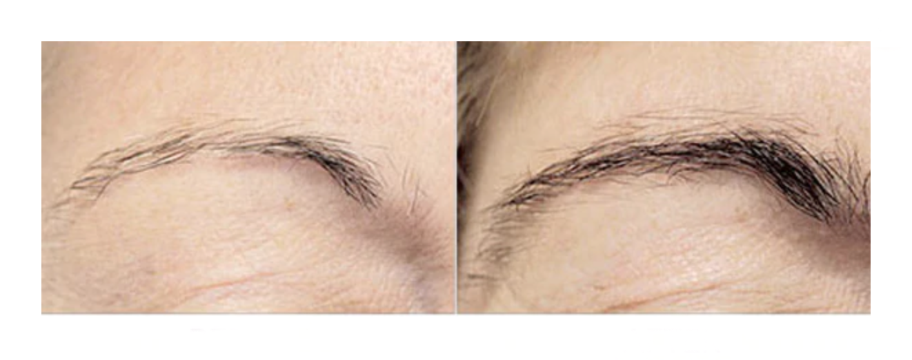 RapidBrow Eyebrow Enhancing Serum - rapidlash