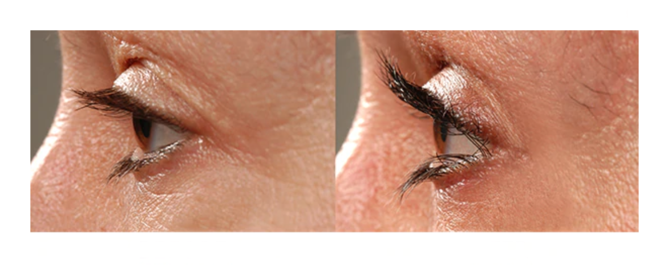 RapidLash Eyelash Enhancing Serum - rapidlash